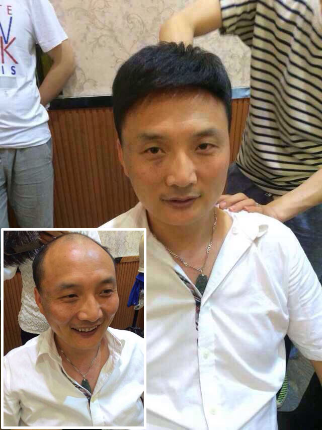 对比效果 杭州萧山丝丝新语假发店